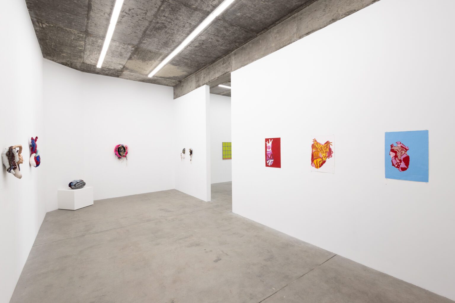 Exhibitions - Arts Project Australia