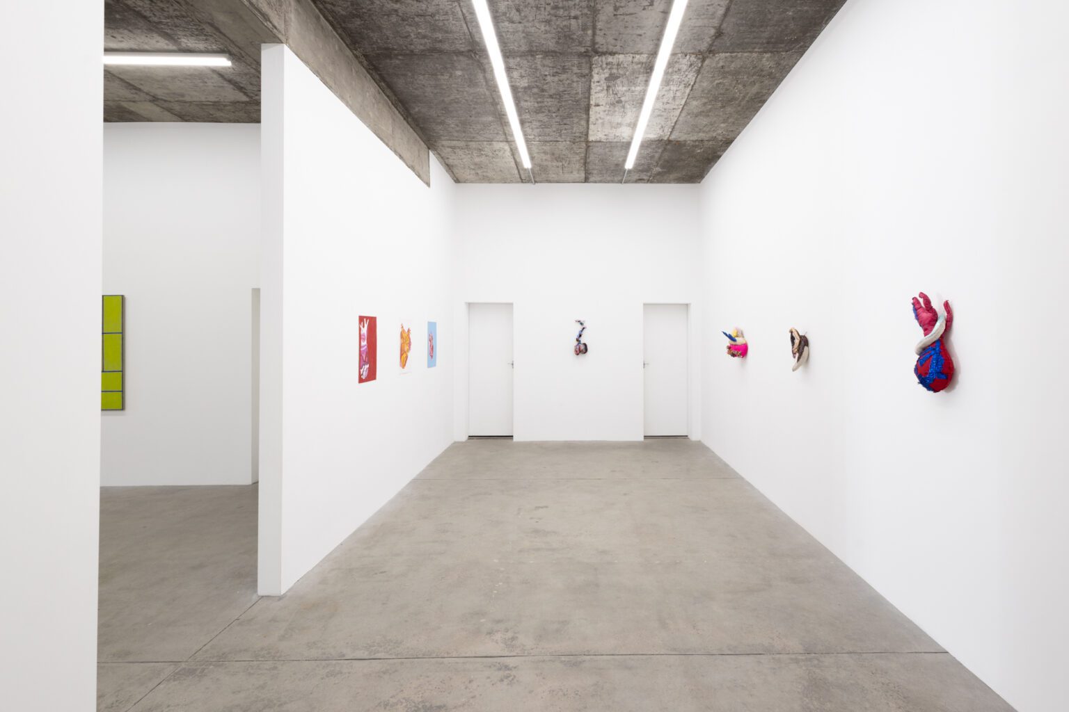 Exhibitions - Arts Project Australia